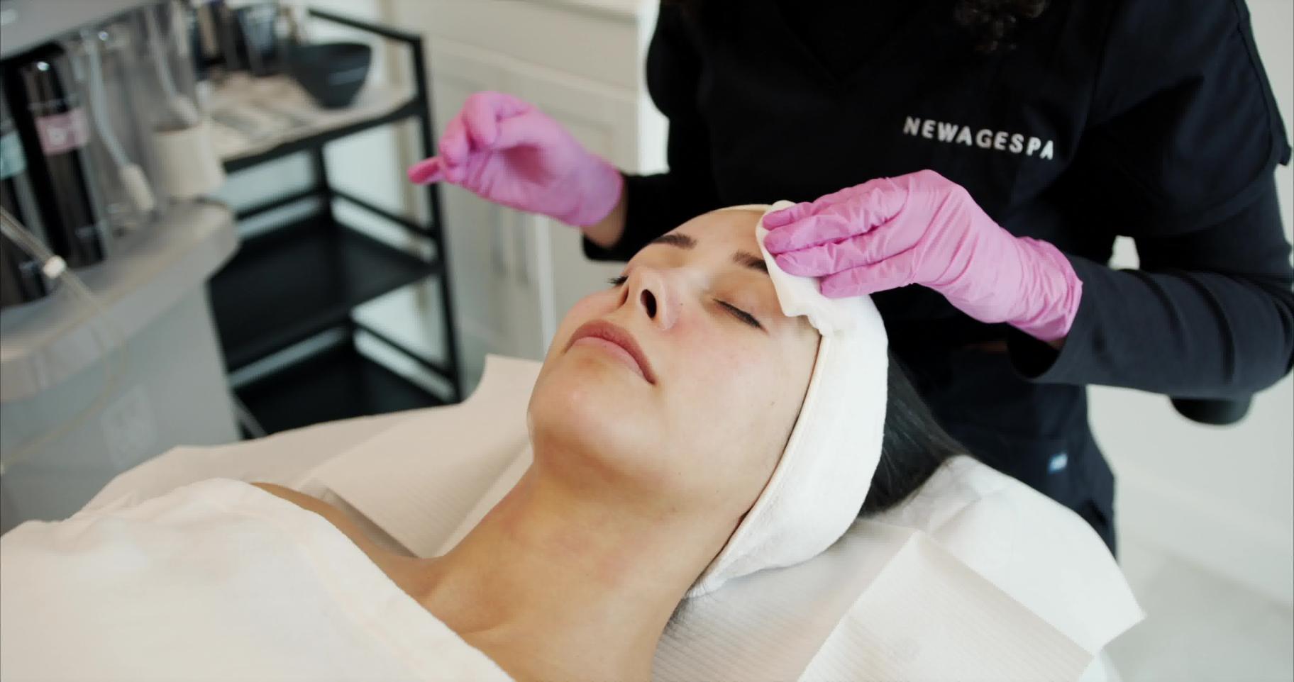 Stretch Marks Microneedling (DP4) Laval: How It Works - NEW AGE SPA